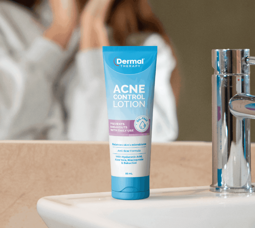 Acne Control Lotion | Treatments for acne skin | Dermal Therapy